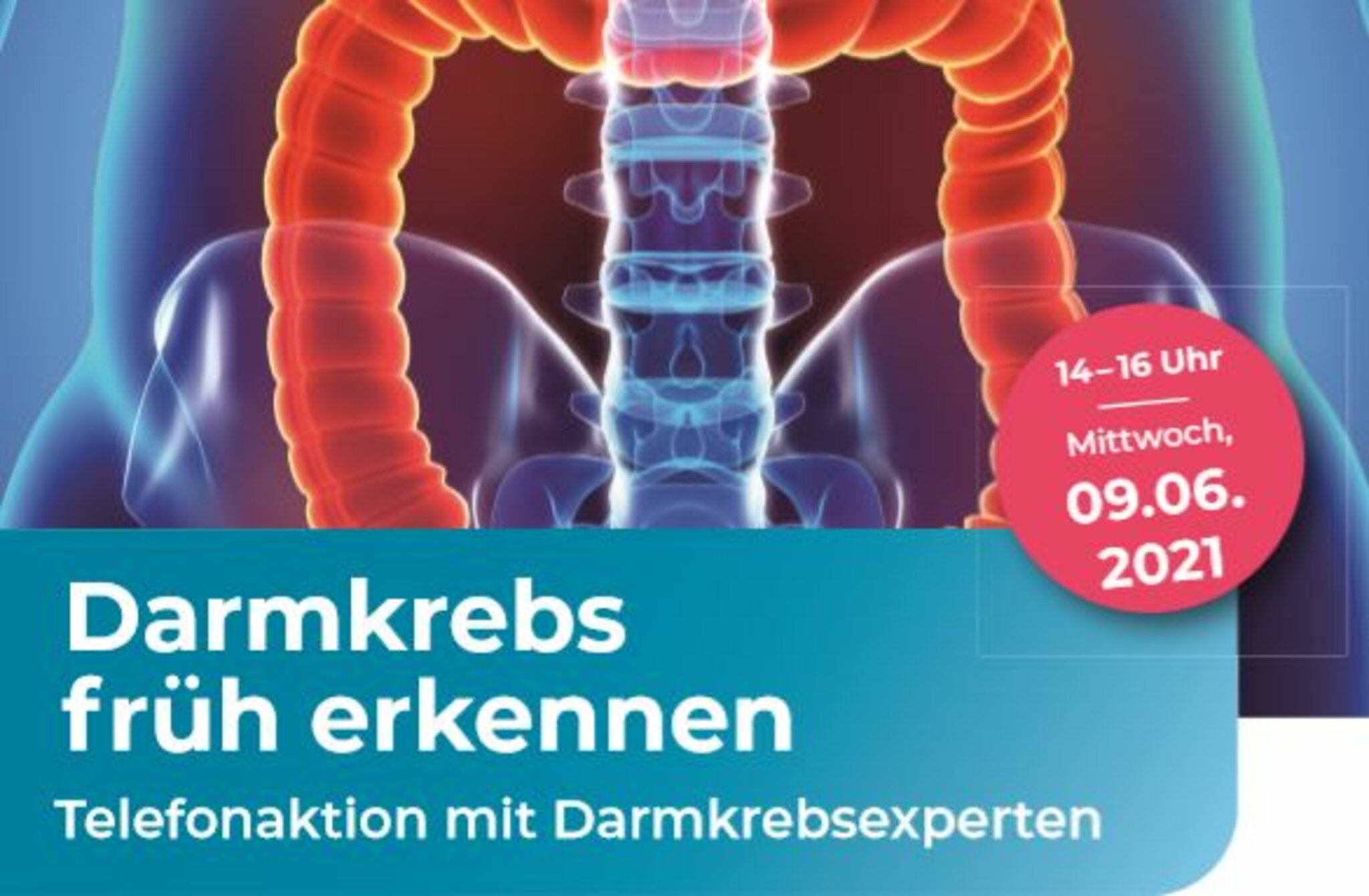 Darmkrebs früh erkennen - Gelsenkirchen